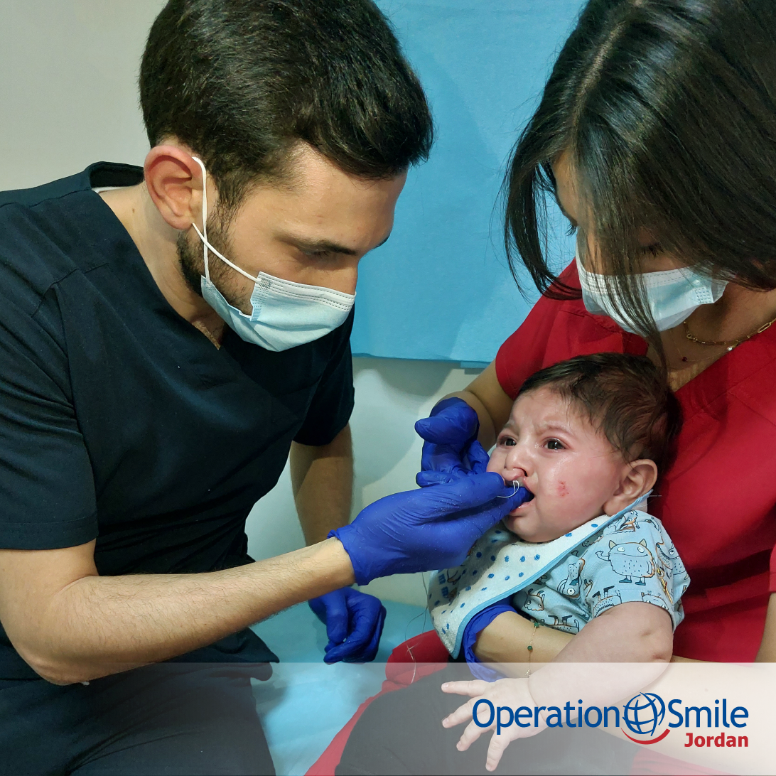 Operation Smile Jordan started providing a new pre surgical treatment ...